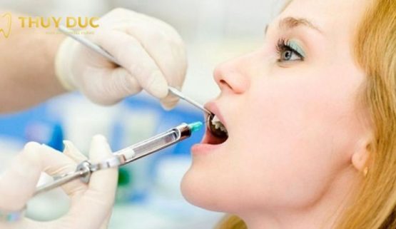 Tất cả lưu ý bạn nhất định phải biết trước - sau nhổ răng khôn