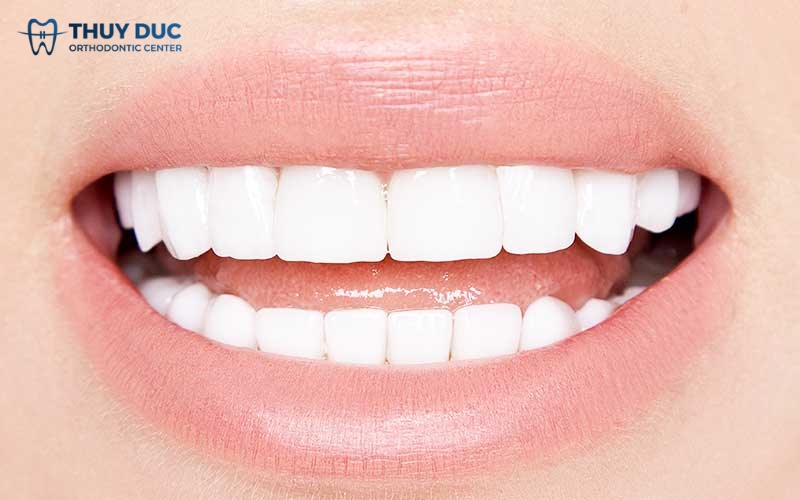 Lưu ý quan trọng khi chọn nha khoa bọc răng sứ thẩm mỹ - Nha Khoa Thúy Đức