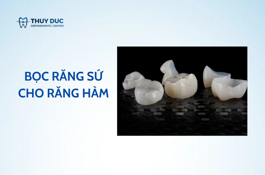 Bọc răng sứ cho răng sâu bao nhiêu tiền? Bảng giá 2026