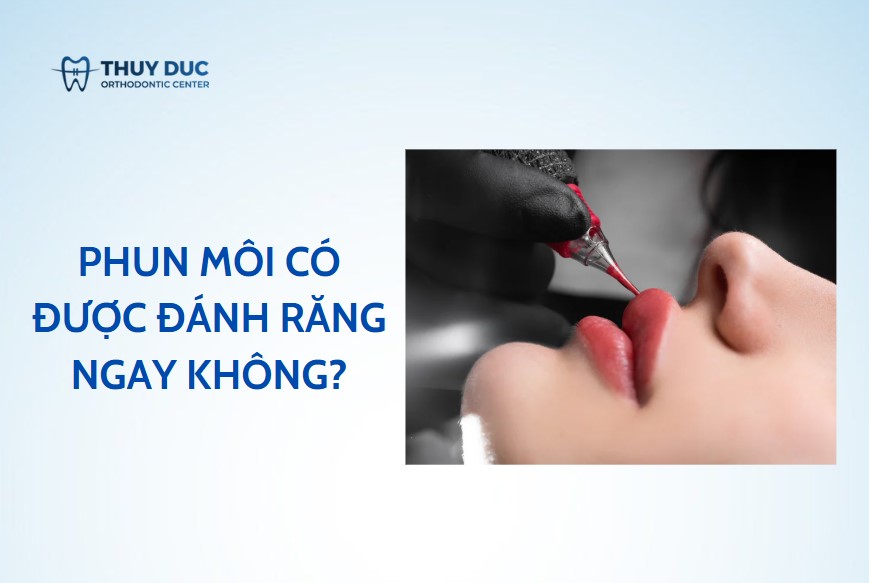 Phun môi có được đánh răng ngay không? - Nha Khoa Thúy Đức