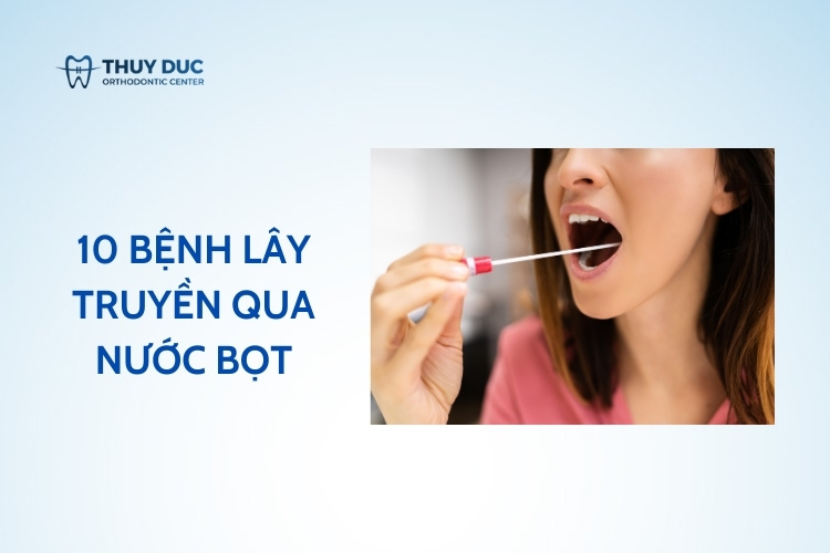 10 bệnh bệnh lây qua đường nước bọt - bạn biết chưa?